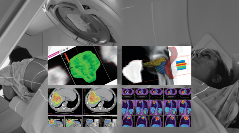 DOSIsoft: Constant Innovation In “patient-specific” Dosimetry for ...